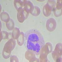 Kyles Workspace Kyles Workspace W6mzp Roboflow Universe