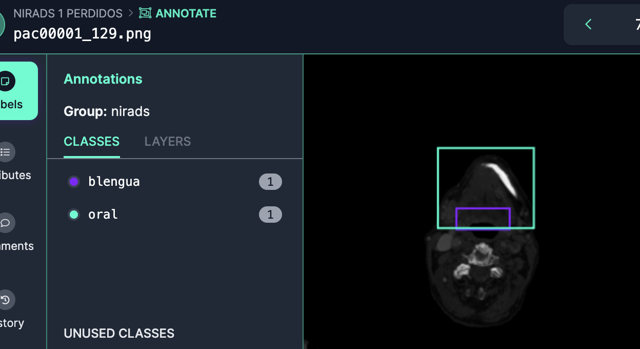 Top Blengua Datasets and Models | Roboflow Universe