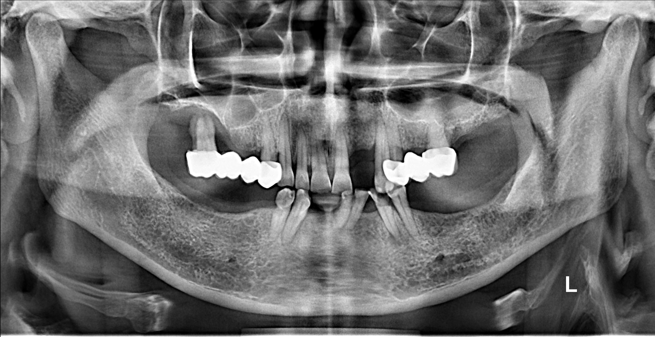 implant Object Detection Dataset by COMSATS