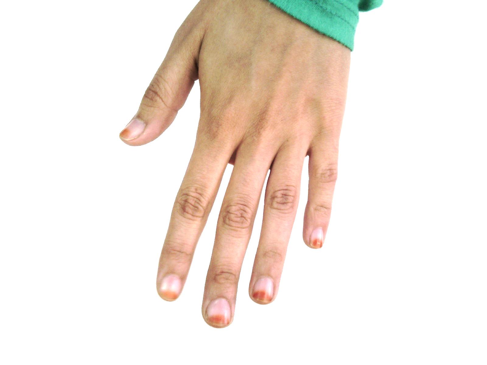 finger_v1 Object Detection Model by fingerDetection