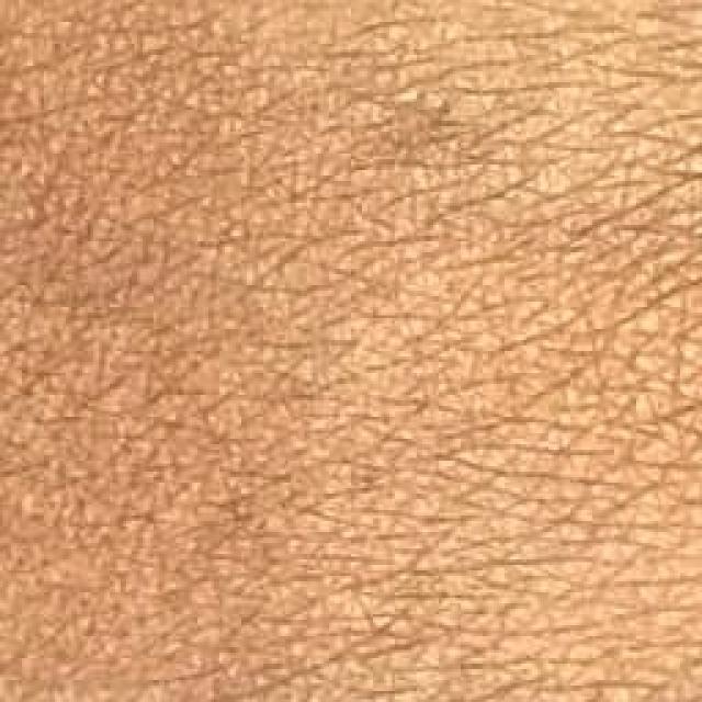 melanoma Classification Model by melanomadetect