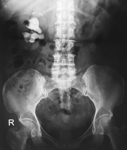 KUB XRAY Object Detection Dataset by pp project