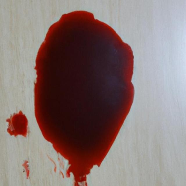 blood and voilance Object Detection Dataset and Pre-Trained Model by ...