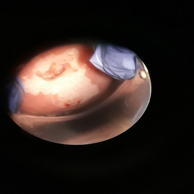 via-test Object Detection Dataset and Pre-Trained Model by VIA dataset