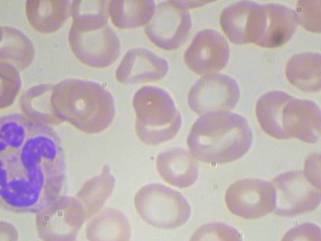 Object Detection Plant Leaf Object Detection Dataset By Objectdetection