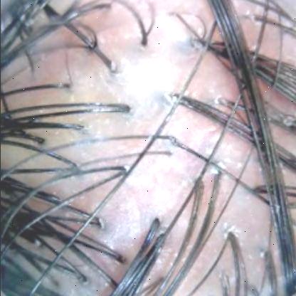 Prova Object Detection Model by xRunda