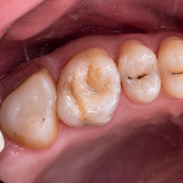 Crowns Icdas Merged Object Detection Dataset By Code Geass