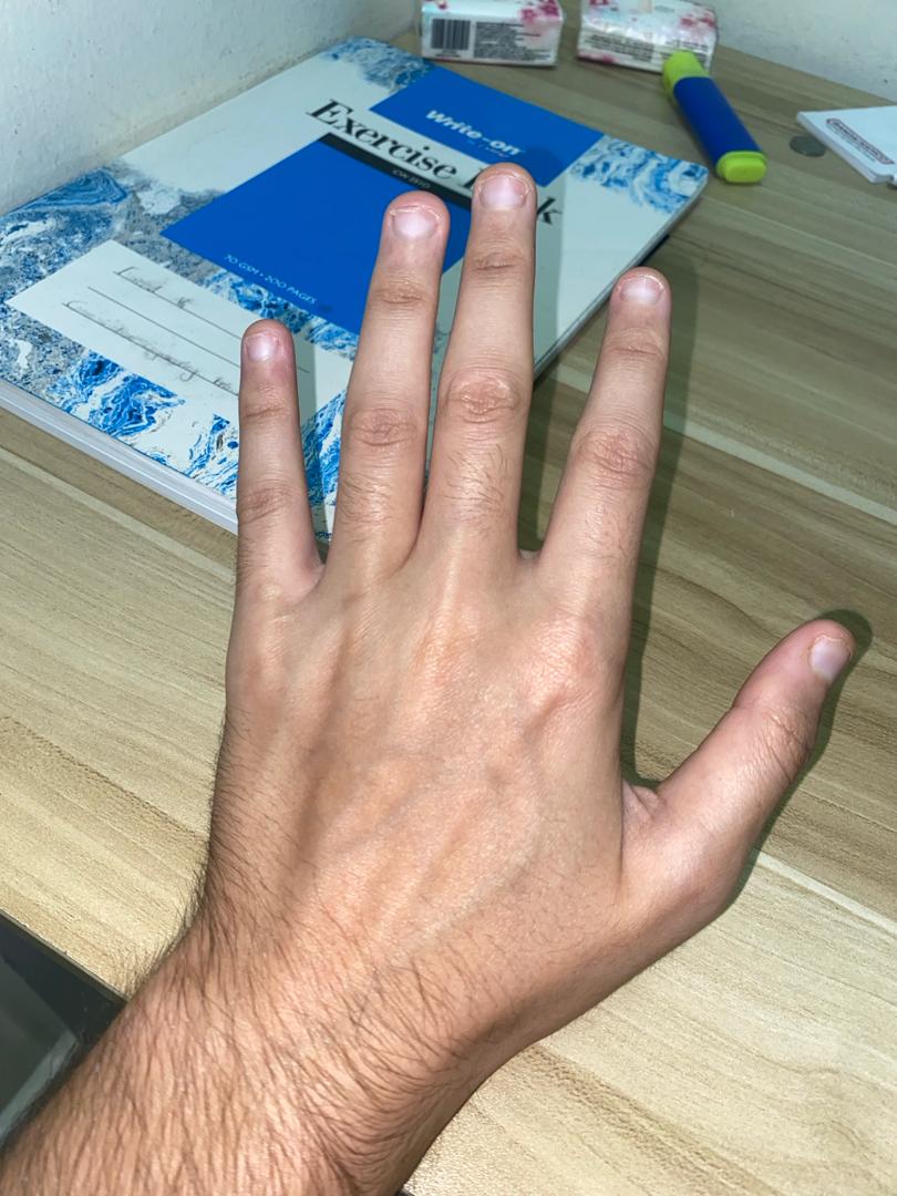 Hand Orientation Object Detection Dataset By Hand Detection 5250