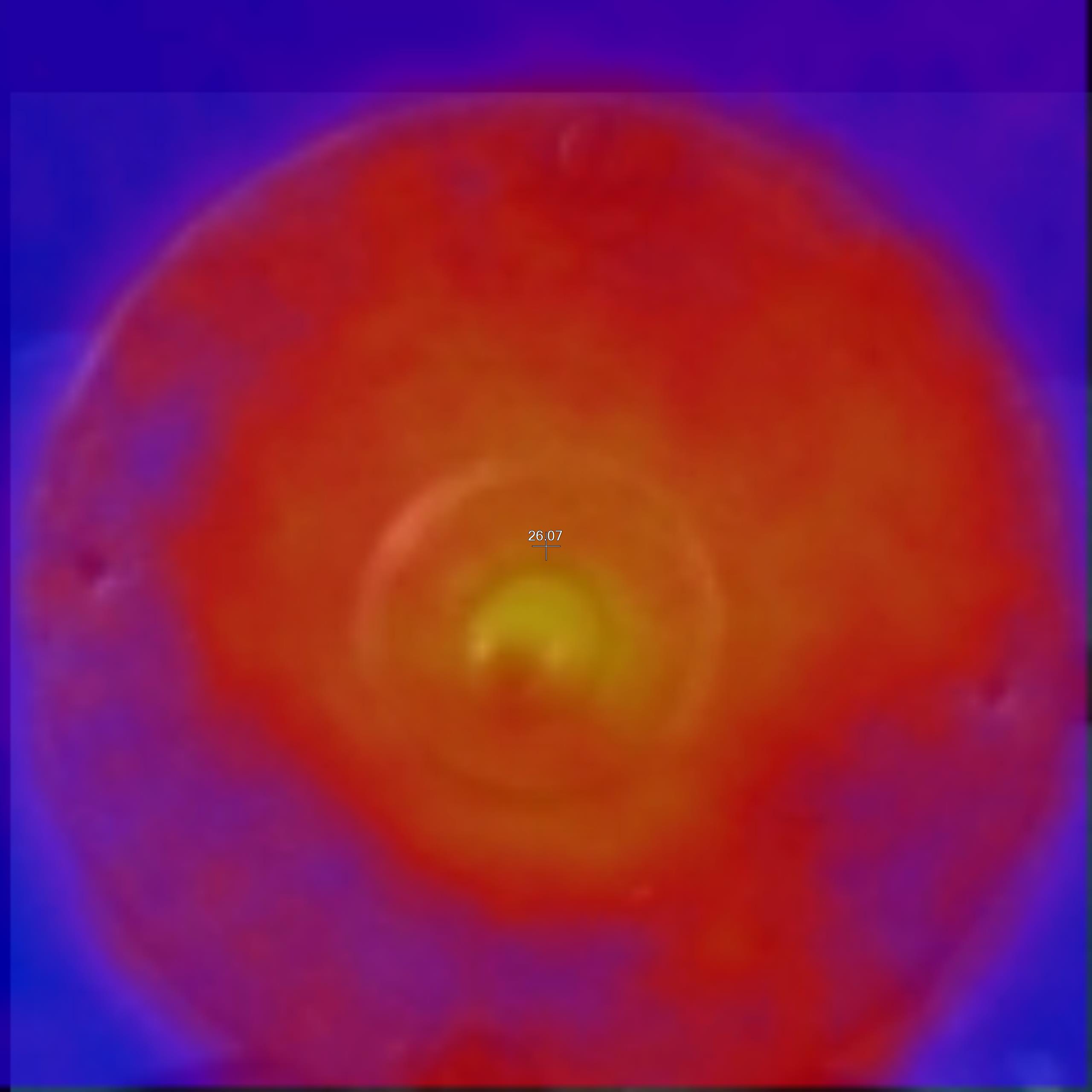 classification (classification-npdnt) - Roboflow Universe