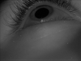 iris key Keypoint Detection Dataset by iris