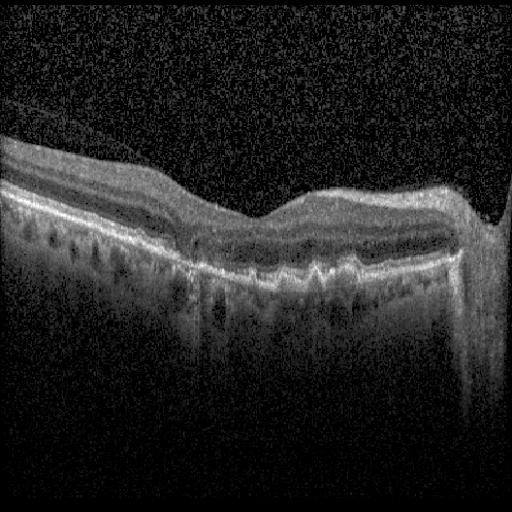 oct semantic Semantic Segmentation Model by cocoyolo