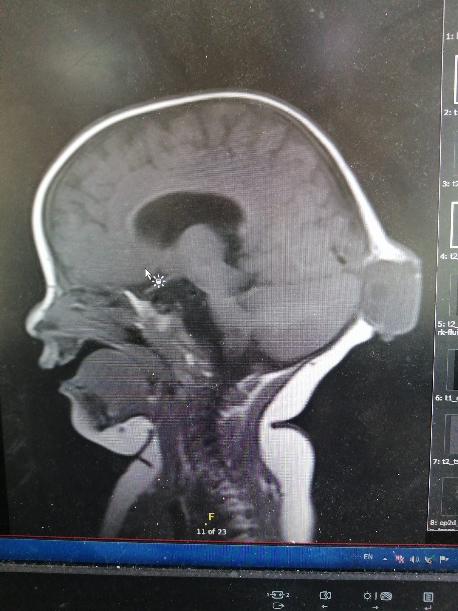 example-dataset Object Detection Model by bessme