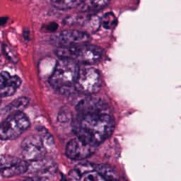 panNuke-object-detection Object Detection Dataset by ...