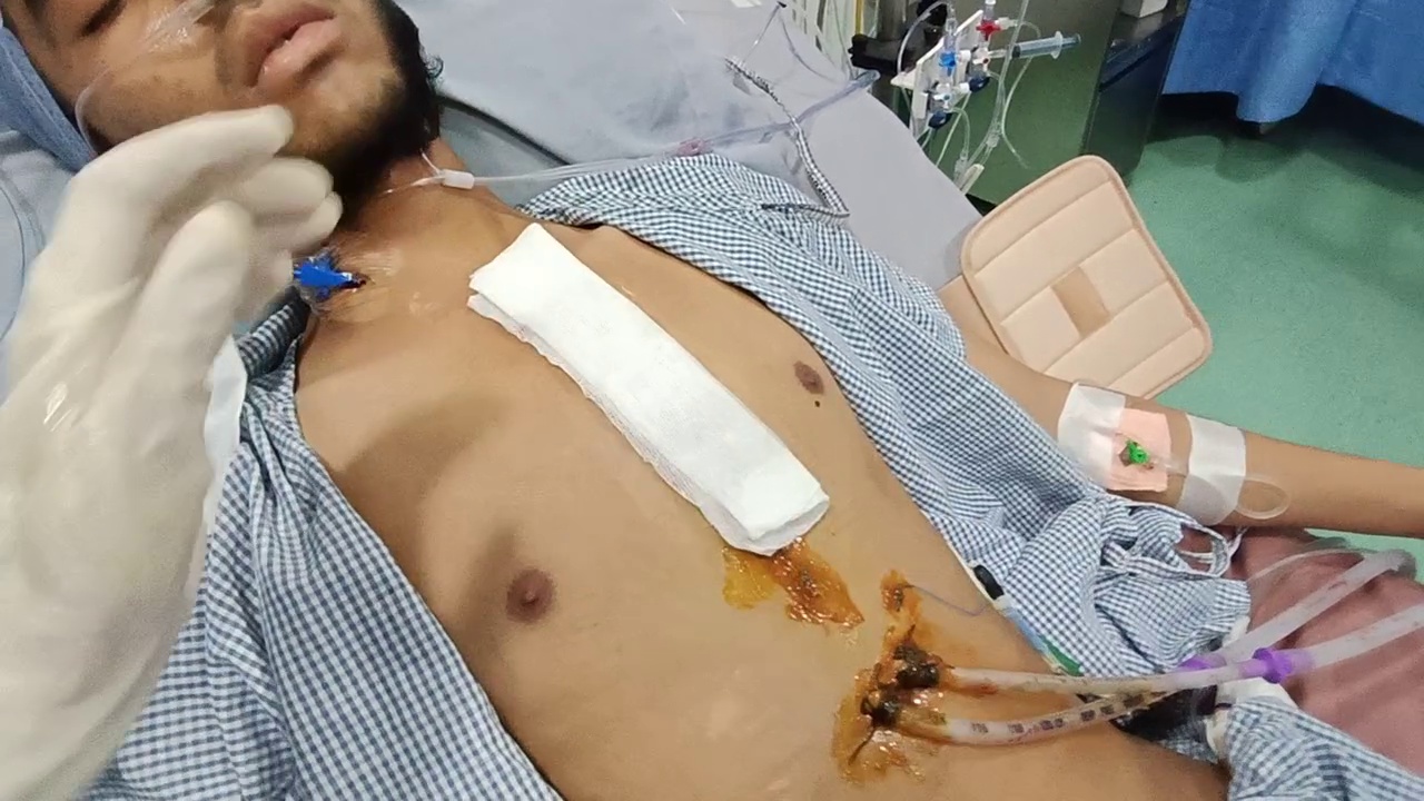 Dressing Rohit Project Object Detection Dataset By Rohit Gautam