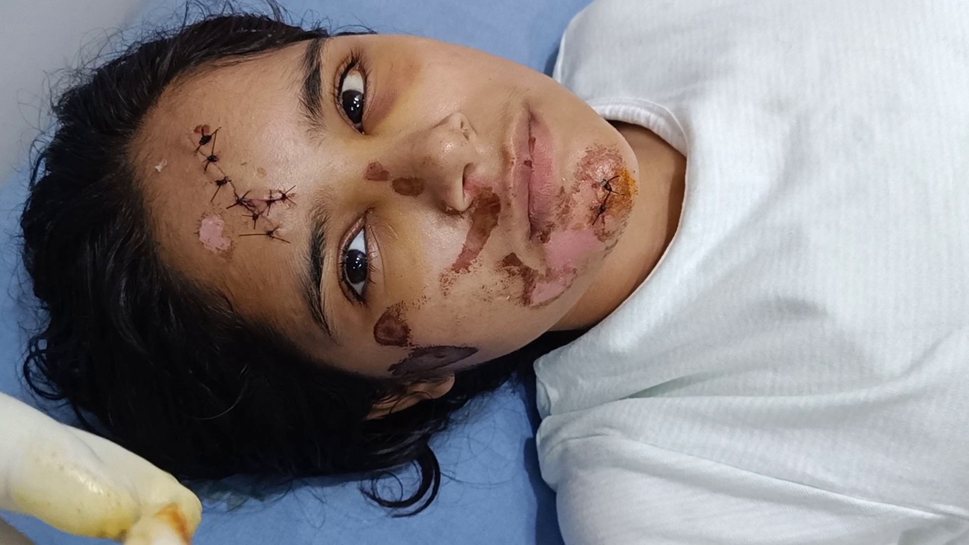 Ssi Bundle Care Object Detection Dataset By Rohit Gautam