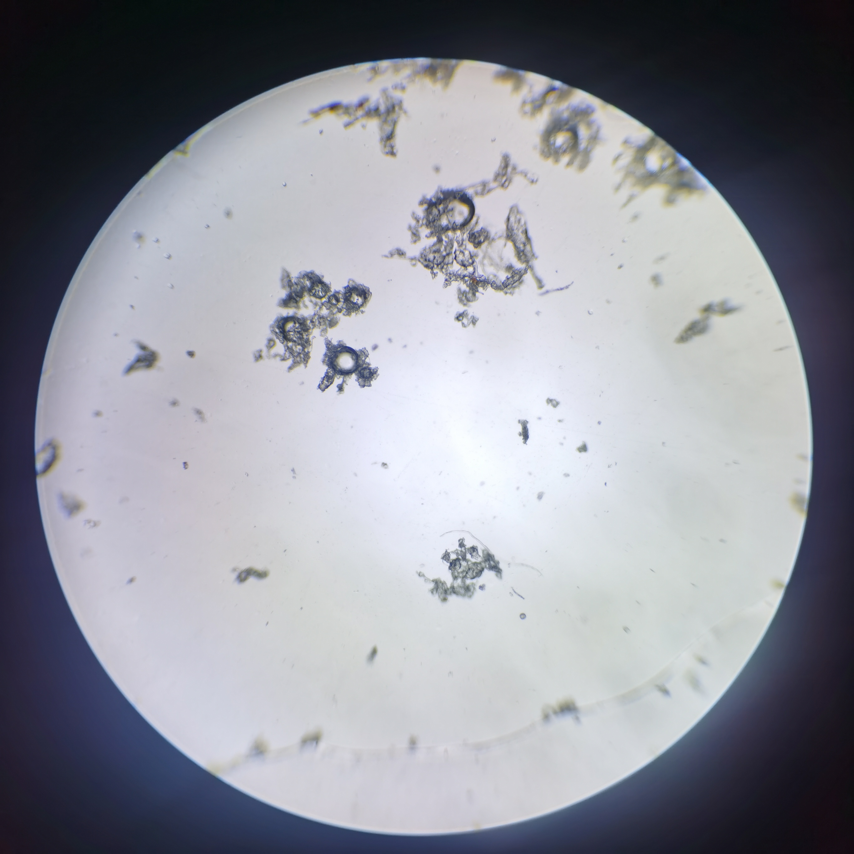 Microplastic Detection Train Object Detection Dataset By De La Salle University