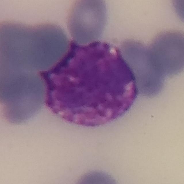 Combined_Data Object Detection Dataset by bloodcell