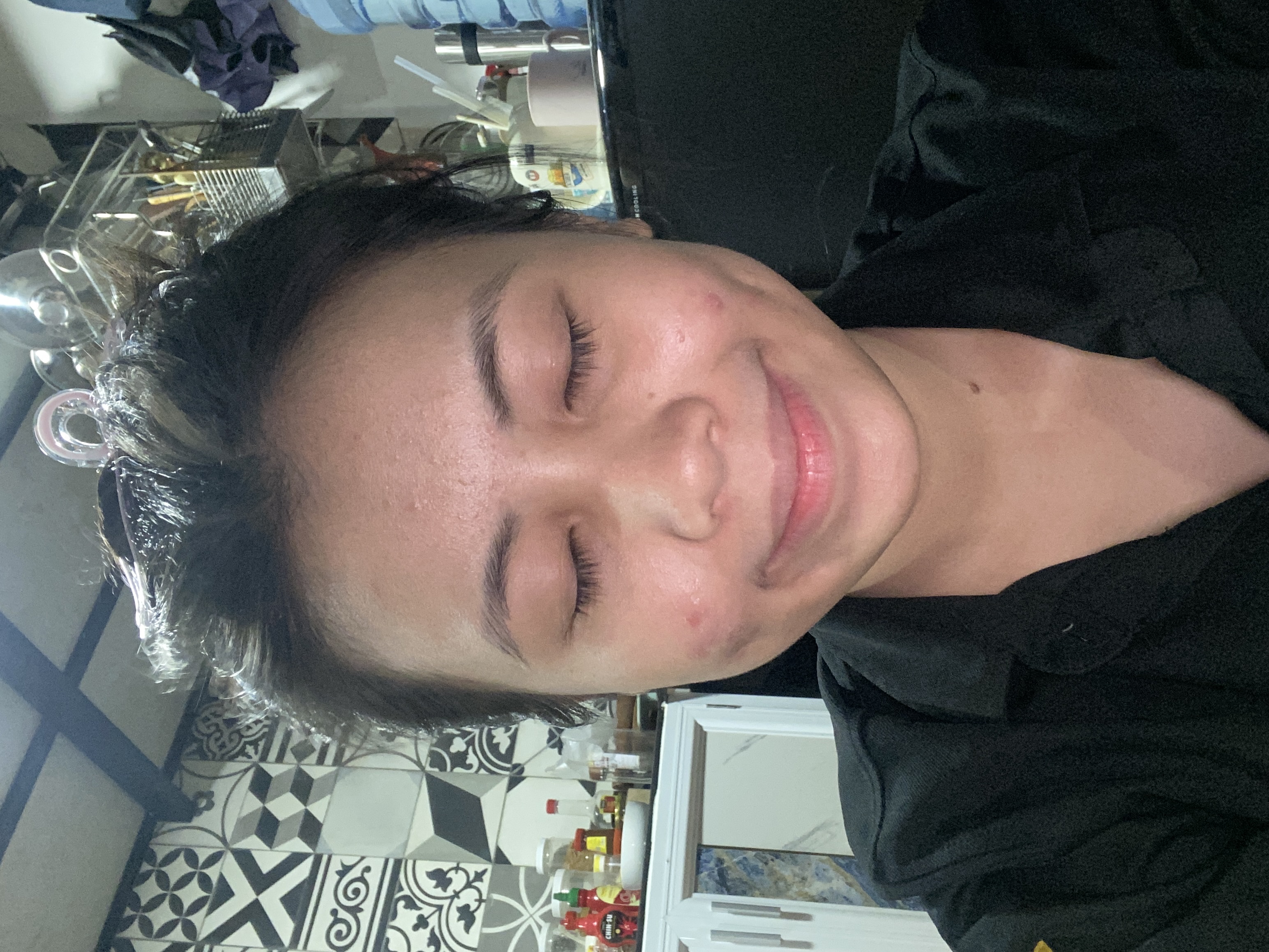 Top Hyperpigmentation Datasets and Models | Roboflow Universe