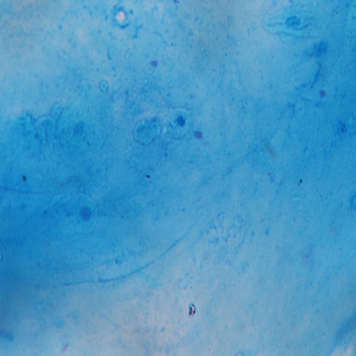 Good Stain Model Object Detection Dataset And Pre Trained Model By