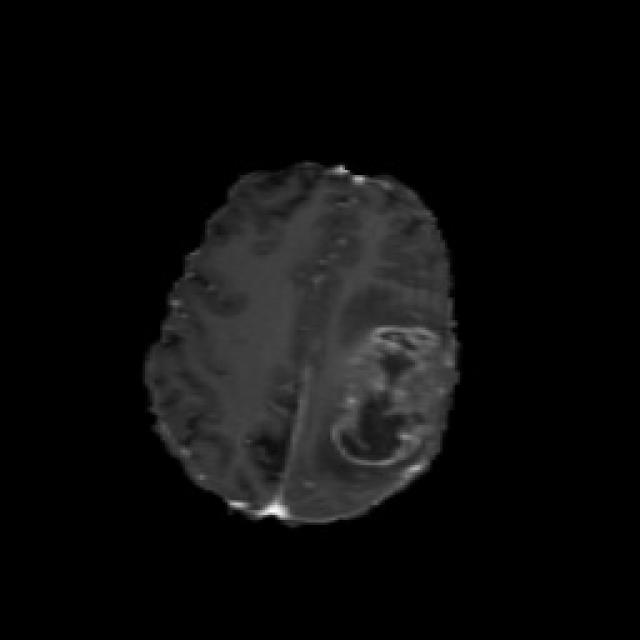 Brain Tumor Object Detection Model By Brain