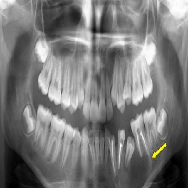 opg_segmentation Instance Segmentation Dataset and Pre-Trained Model by RAMEN