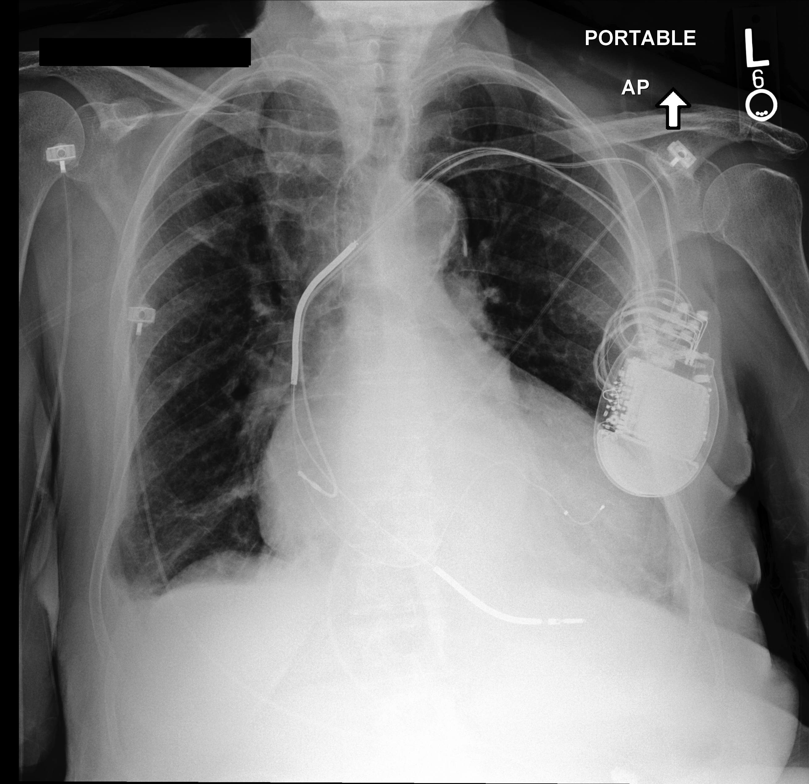 ICD Xray Image Recognition Object Detection Model by Nighthawklvn