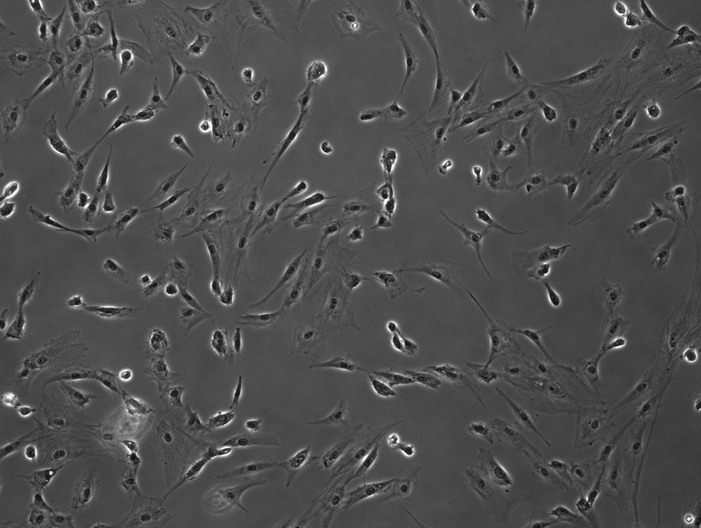 KI-67 Object Detection Dataset by Cell Detection