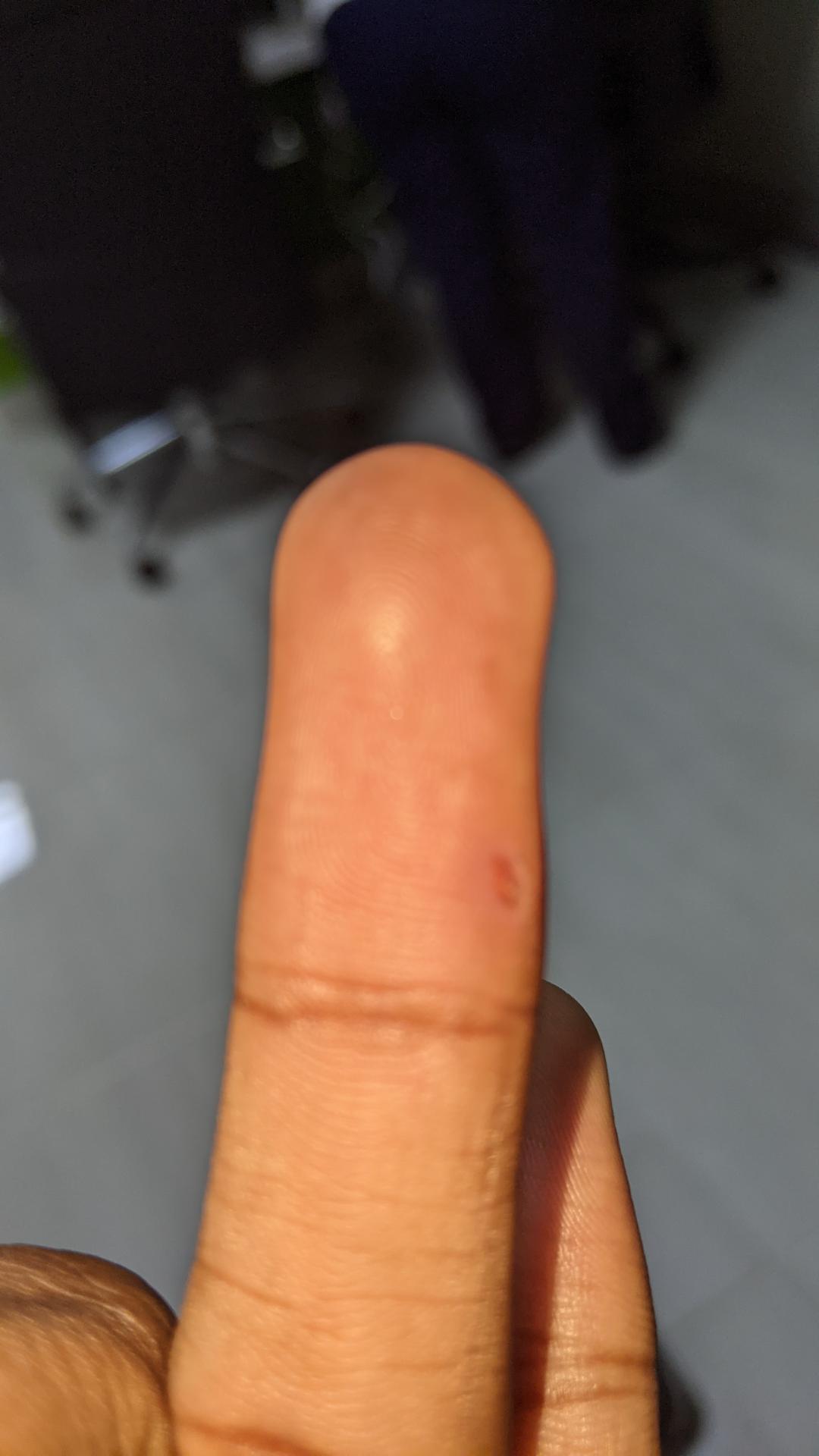 handfinger Classification Dataset by Romeo Betnces