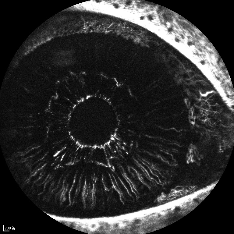 Iris Instance Segmentation Model By Iris