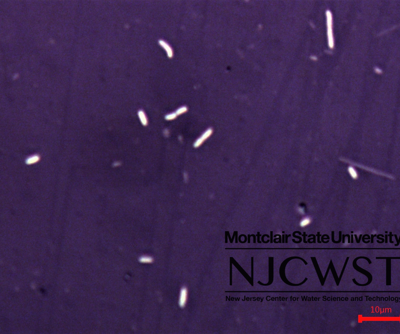 bacteria-data Object Detection Dataset by sumanthvarmadandu