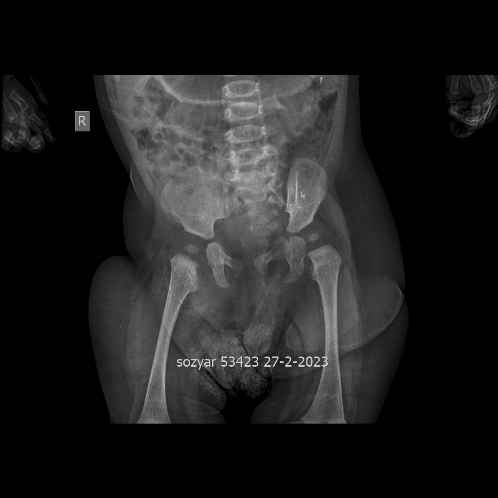 DDH Object Detection Model by Project Final