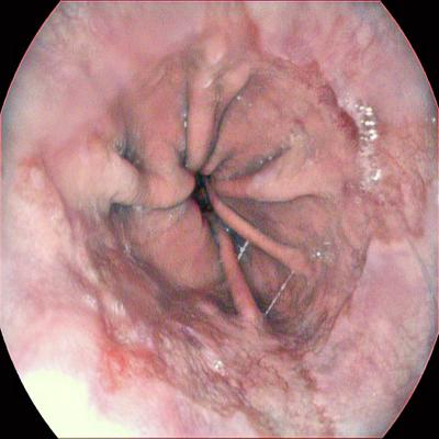 VCTE Instance Segmentation Dataset and Pre-Trained Model by BSCI ...