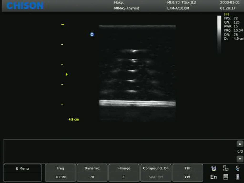 Wire Object Detection Dataset by Chela