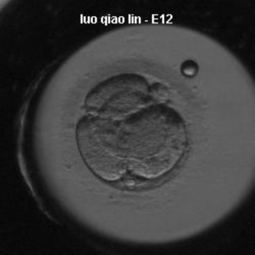 Embryo Object Detection Dataset by PKU