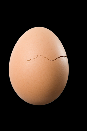 sample Object Detection Dataset by 360digitmg