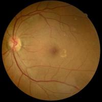 Aptos and DDR - Roboflow Universe