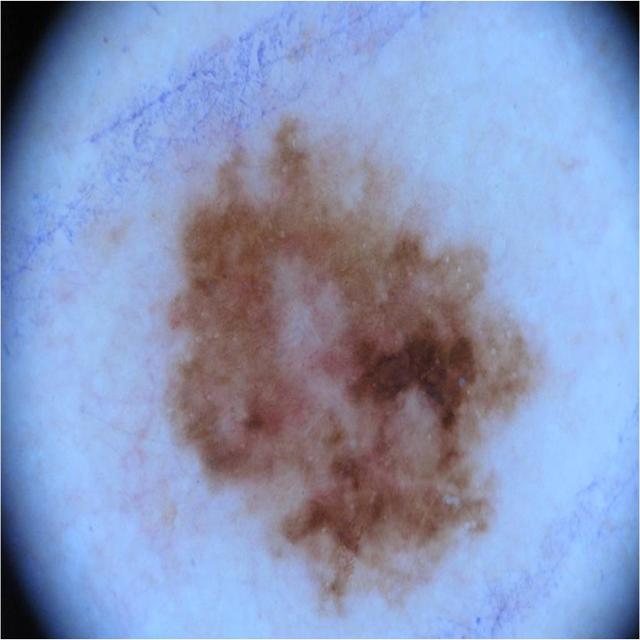 2017 Training Instance Segmentation Dataset by ISIC Project NH