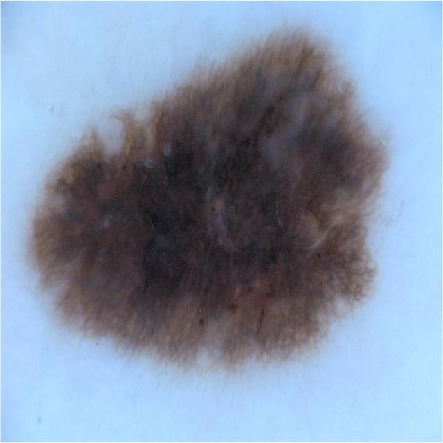 2016 Training Instance Segmentation Dataset by ISIC Project NH