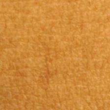 skin Classification Dataset by skinsight