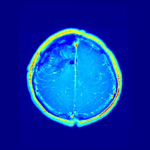 Kicsit (kicsit-mflpb) - Roboflow Universe