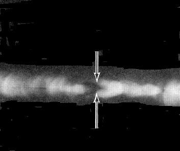 weld-defects Classification Dataset and Pre-Trained Model by asd
