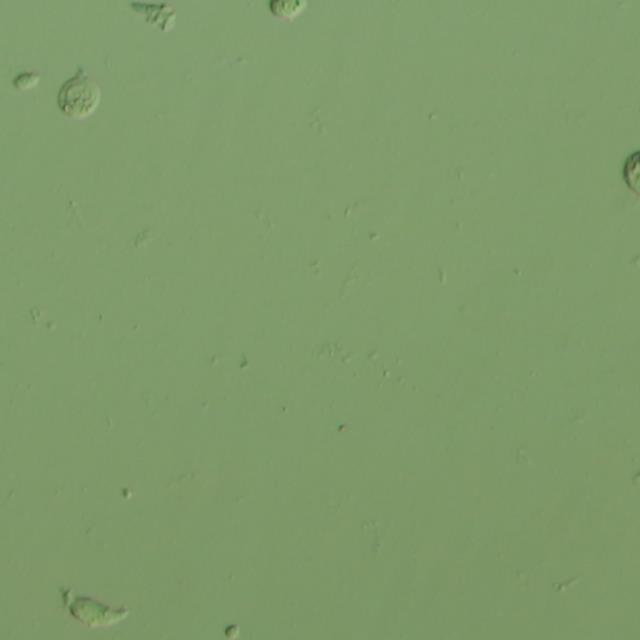 cell counting Object Detection Dataset and Pre-Trained Model by Follicle