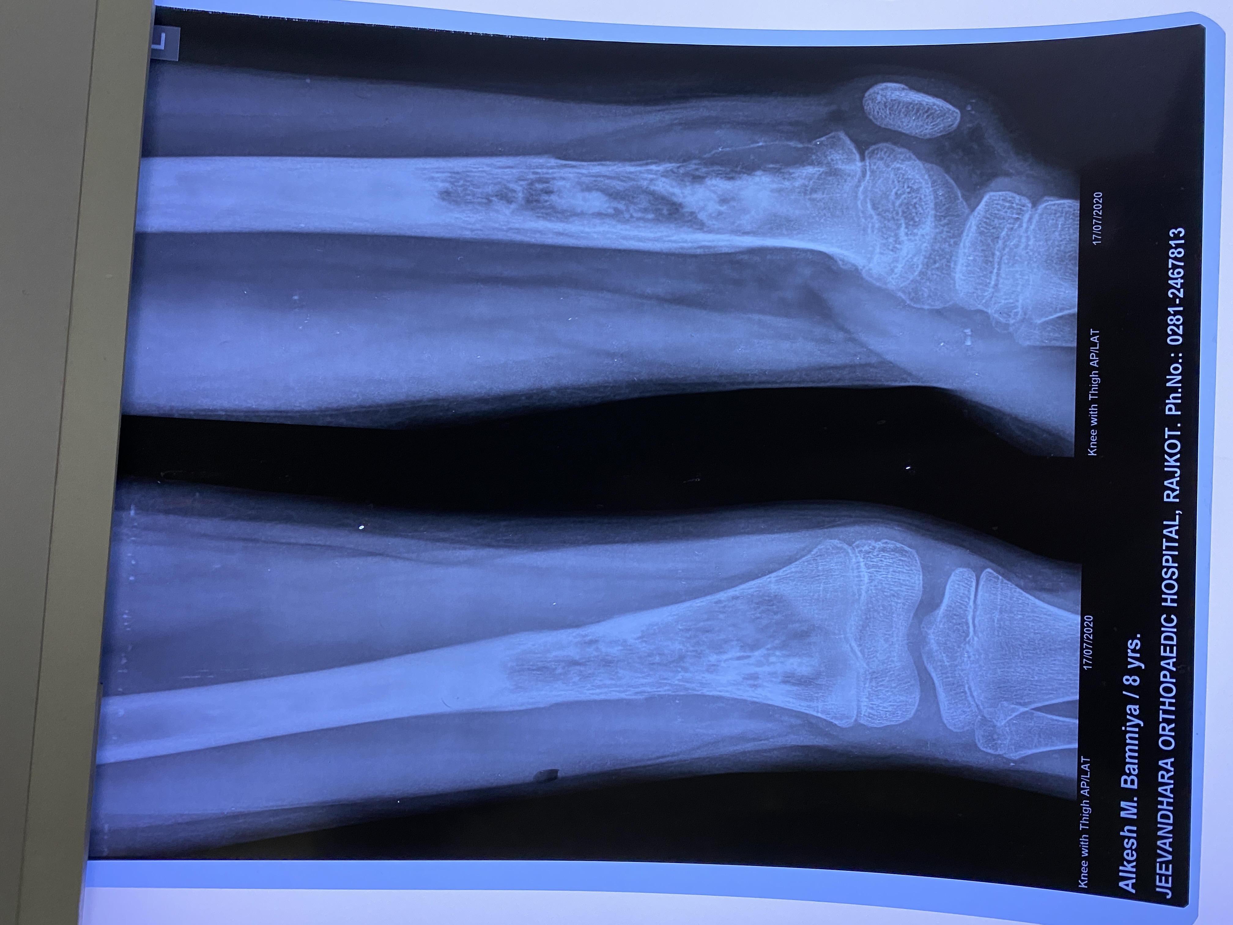 cancer Object Detection Dataset by SAL ENGINEERING AND TECHNICAL INSTITUTE