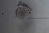 Top Oocyte Datasets and Models | Roboflow Universe