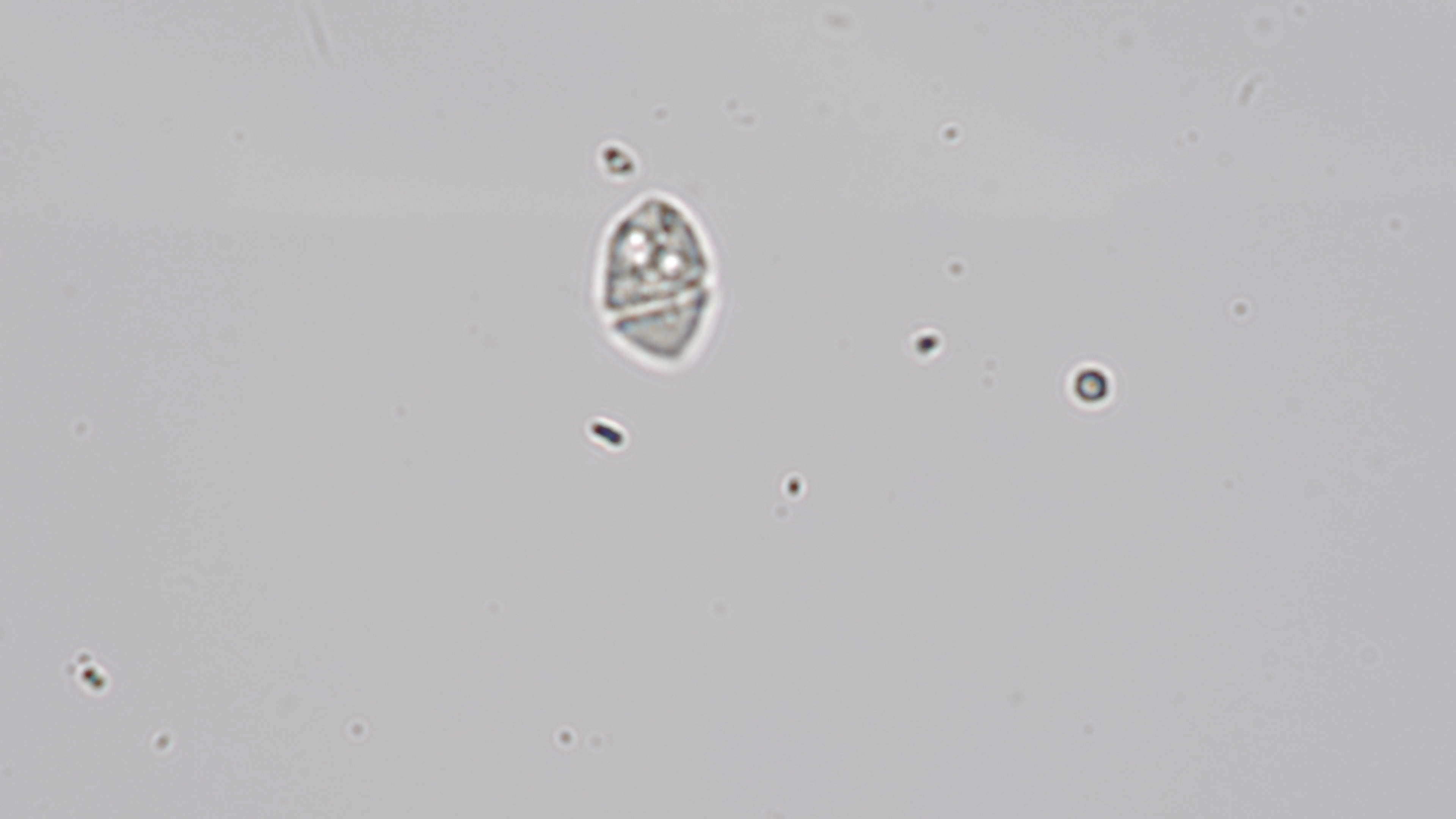 Algae Object Detection Dataset By Algae