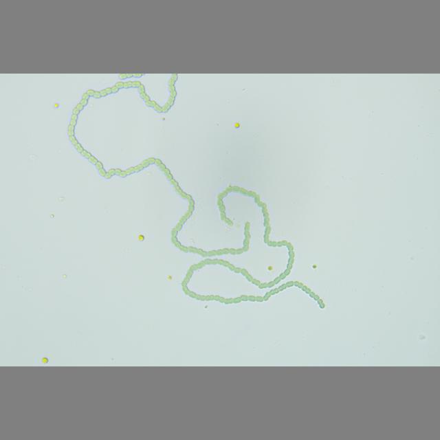 hunhe Object Detection Dataset by algae