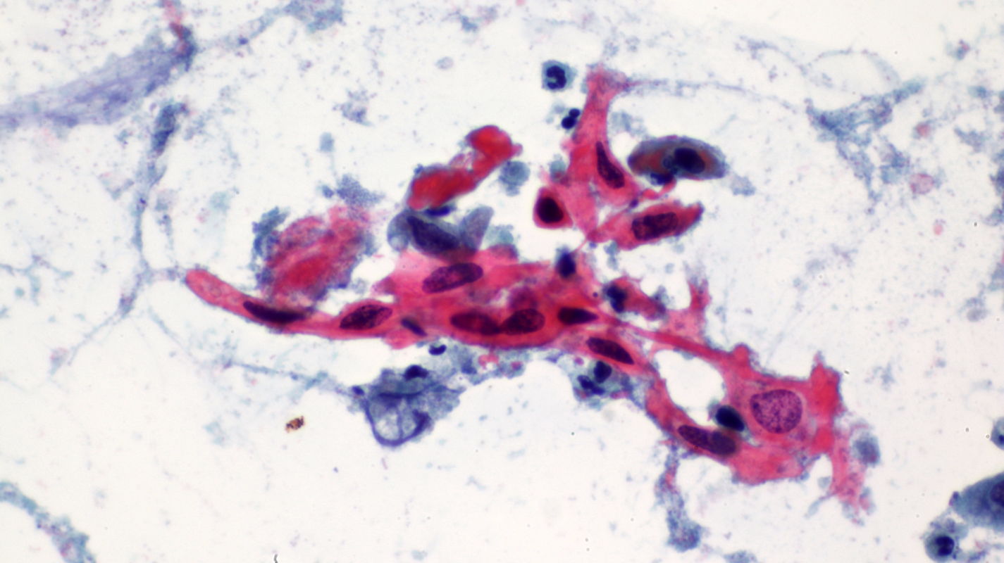 Gyn cytology screening Object Detection Dataset by Cytology