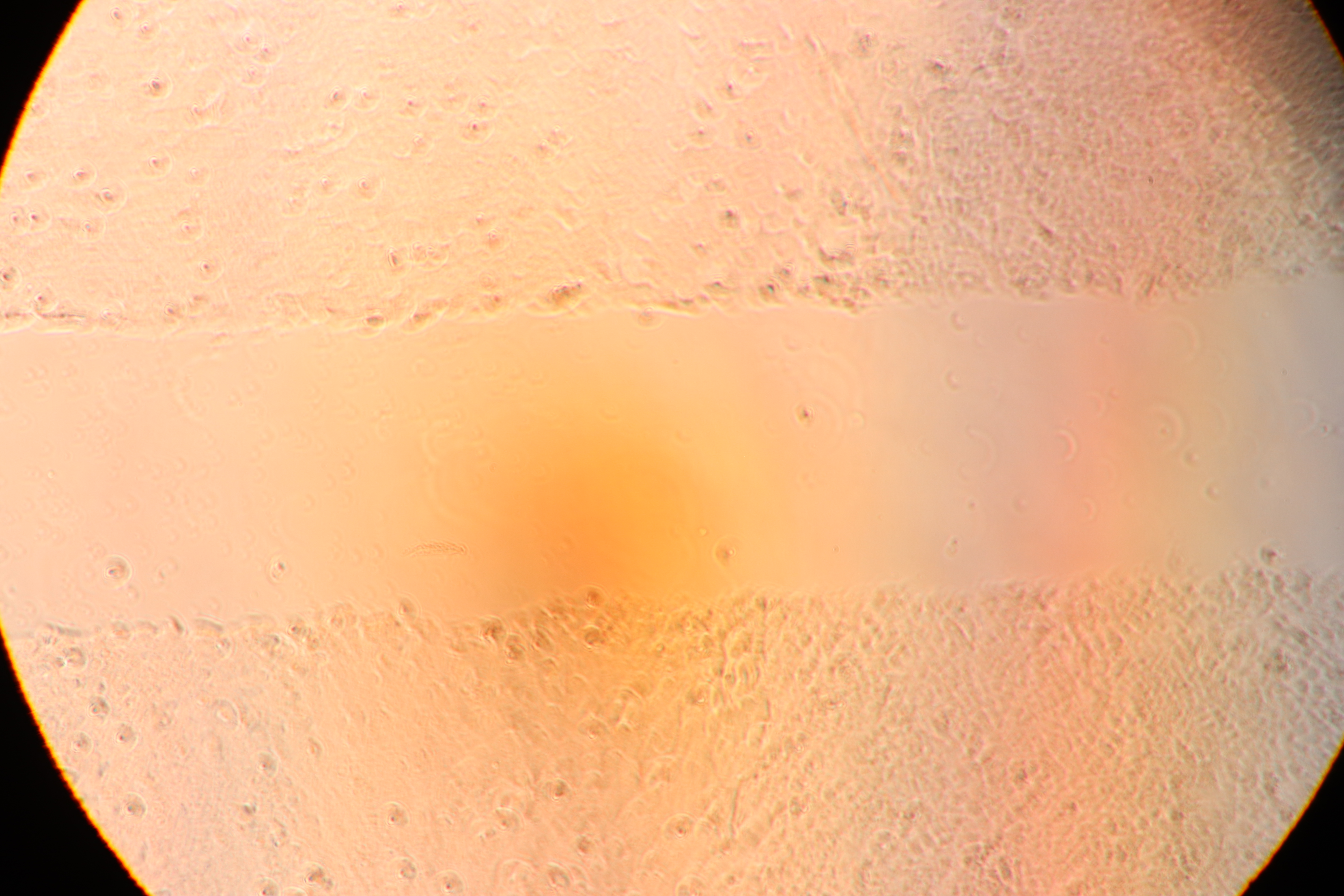 Migration Assay Instance Segmentation Dataset by University of Freiburg