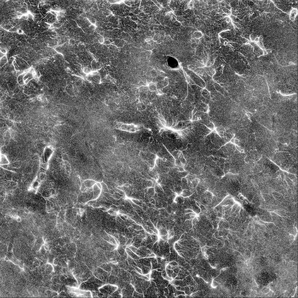 ALS_208_random5 Object Detection Dataset by Sarah Syed