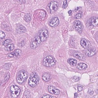 Pathora AI - Roboflow Universe